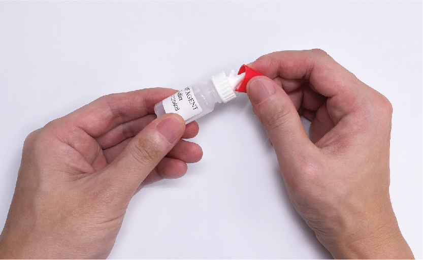 Syphilis (Treponema Pallidum) Antibodies Test - 關懷愛滋 AIDS Concern